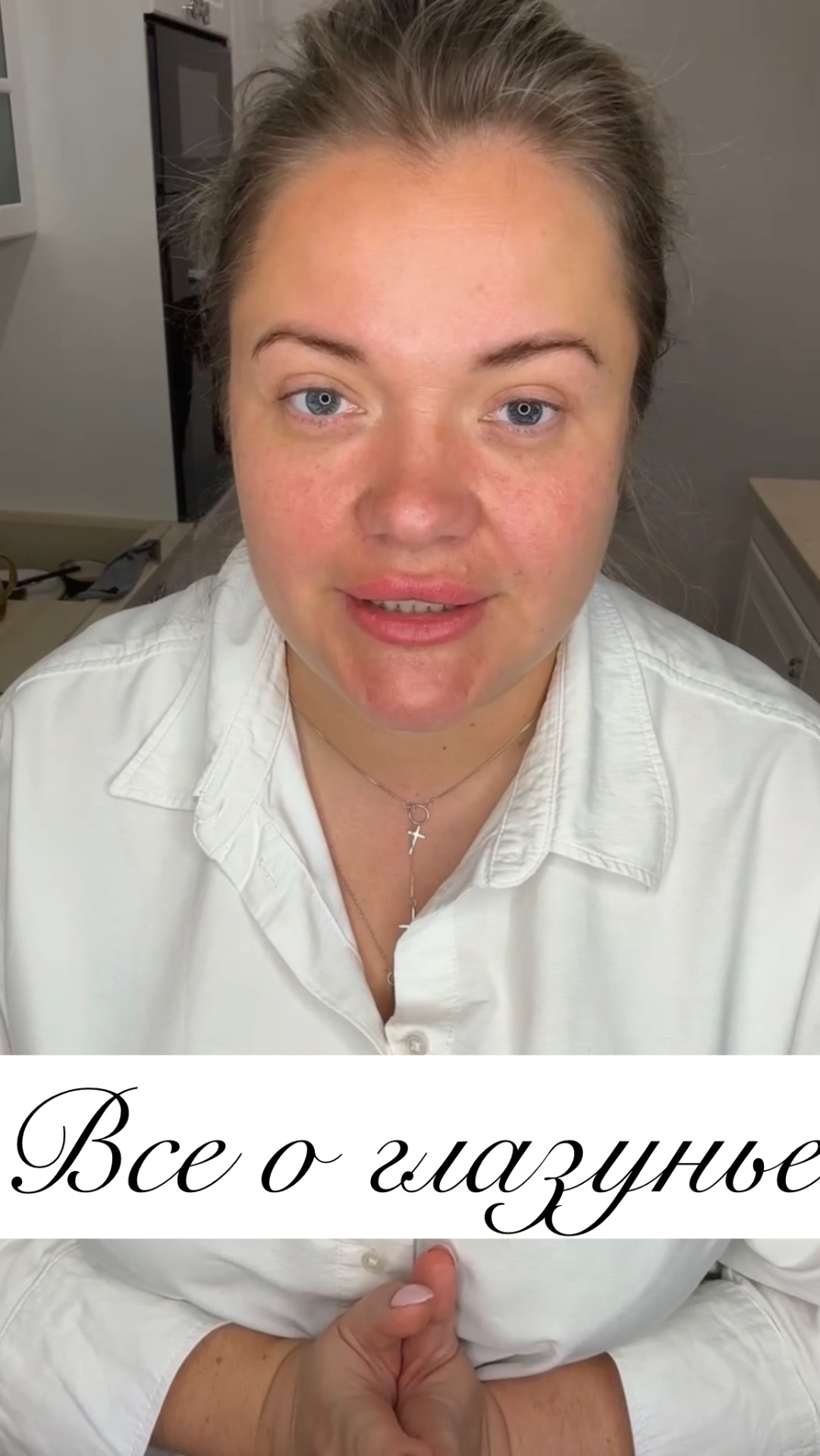 ВСЕ О ГЛАЗУНЬЕ 🍳