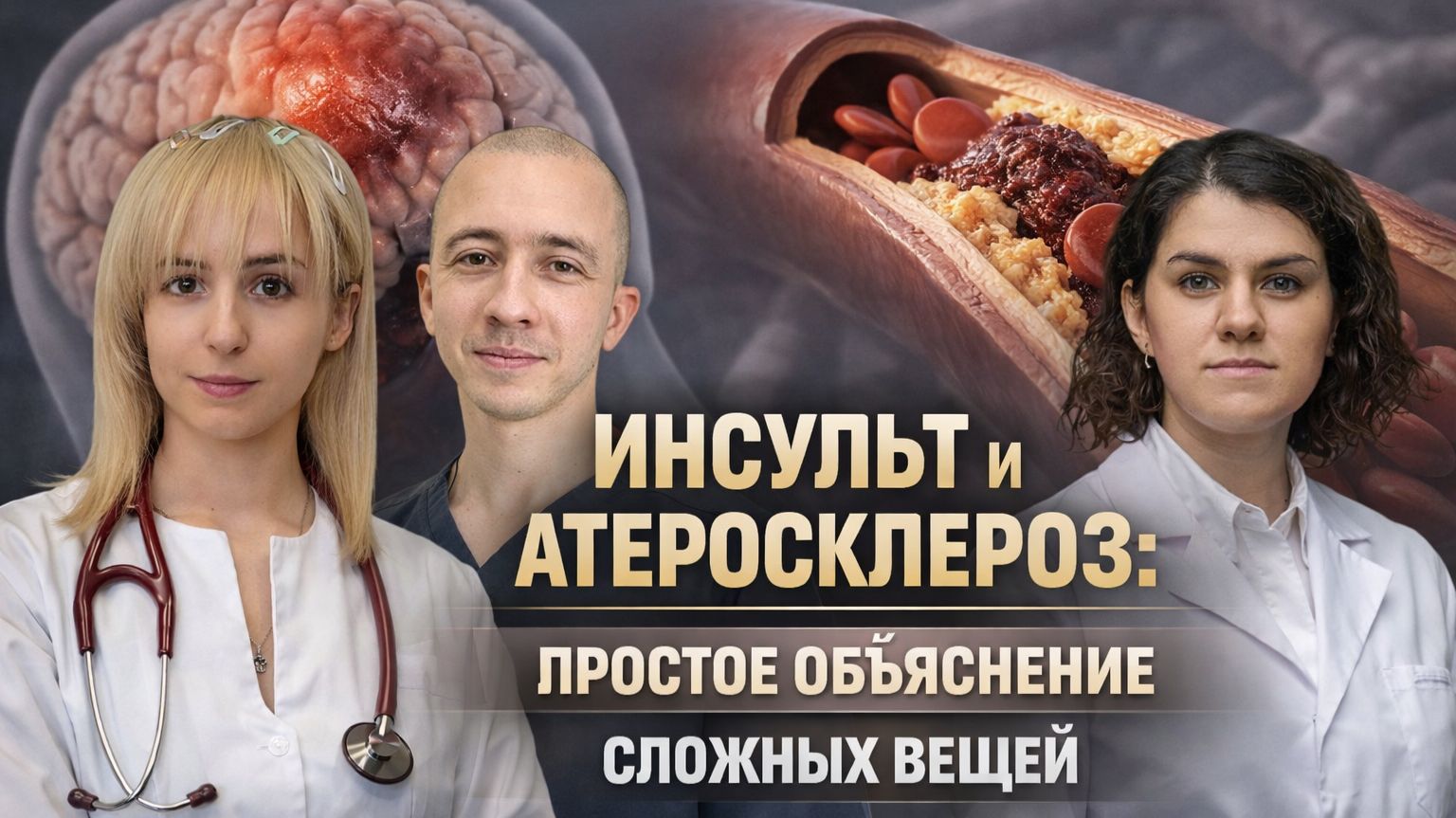 Инсульт: причины, профилактика и современные методы лечения