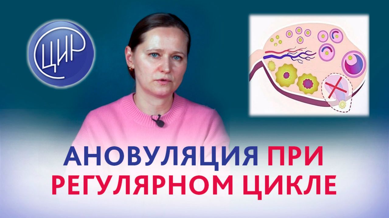 Ановуляция при нормальном цикле - в чём причина? Акушер-гиенколог ЦИР, Оксана Валерьевна Тимофеева