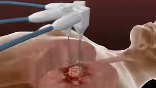 «Фуда», клиника по лечению рака