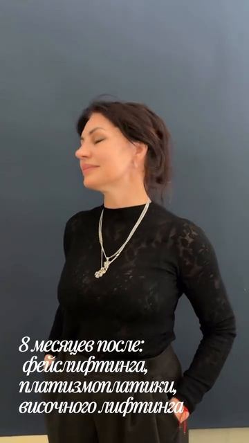 Результат комплексного омоложения лица у Амита Хатри ❤️