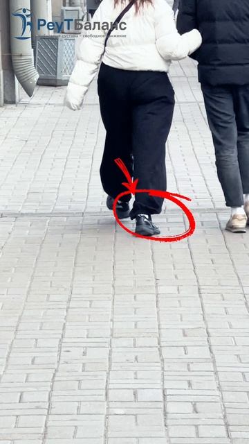Походка с вальгусными стопами
