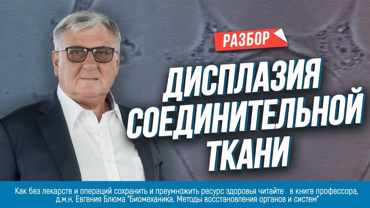 Дисплазия соединительной ткани. Разбор профессора, д.м.н. Евгения Блюма