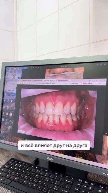 Почему не стоит откладывать лечение зубов. Стоматология Бобров Клиник Москва.