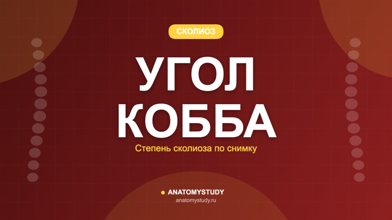 Угол Кобба: как по снимку понять степень сколиоза