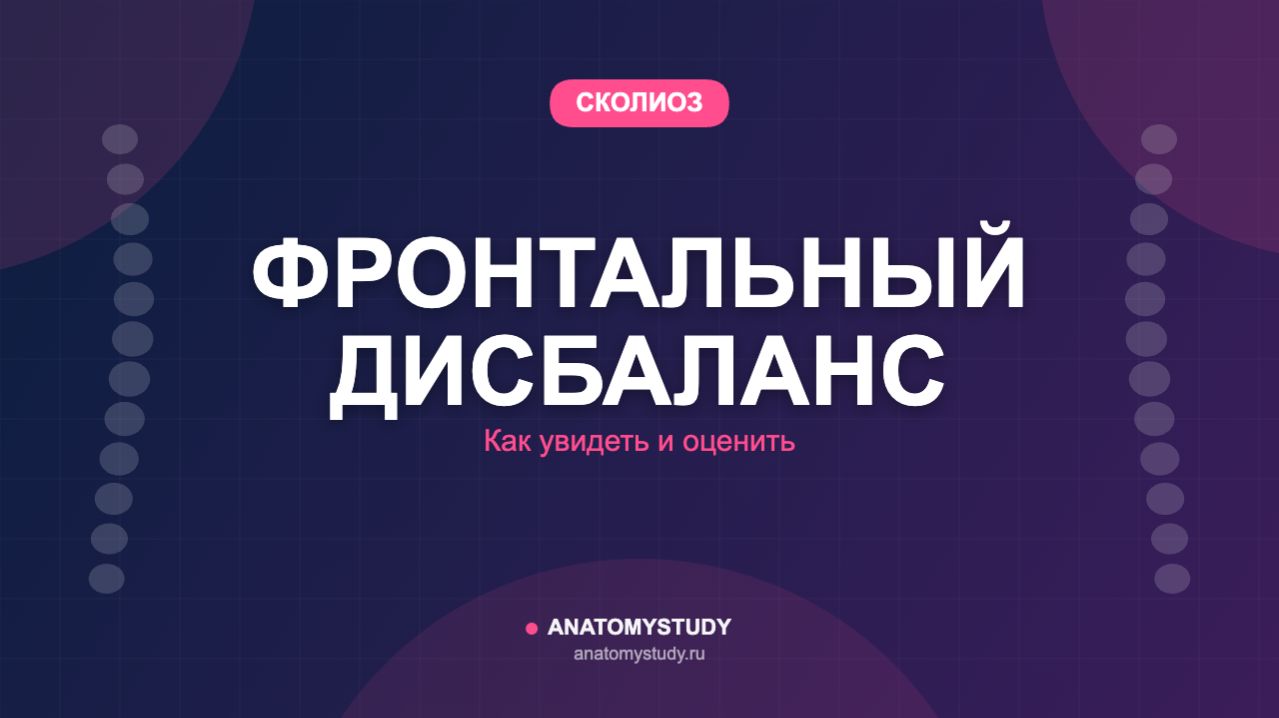 Фронтальный дисбаланс при сколиозе: как его увидеть и оценить