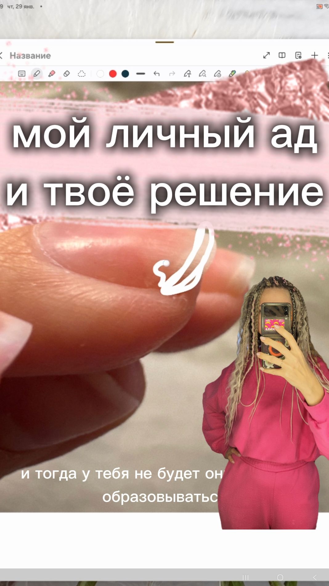 Перепилили ногти! Что делать? Hohtar