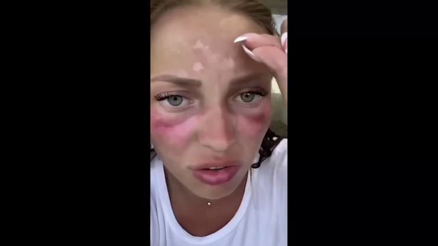 Утренние солнечные лучи полезны для зрения. Но! То же самое солнце является причиной....