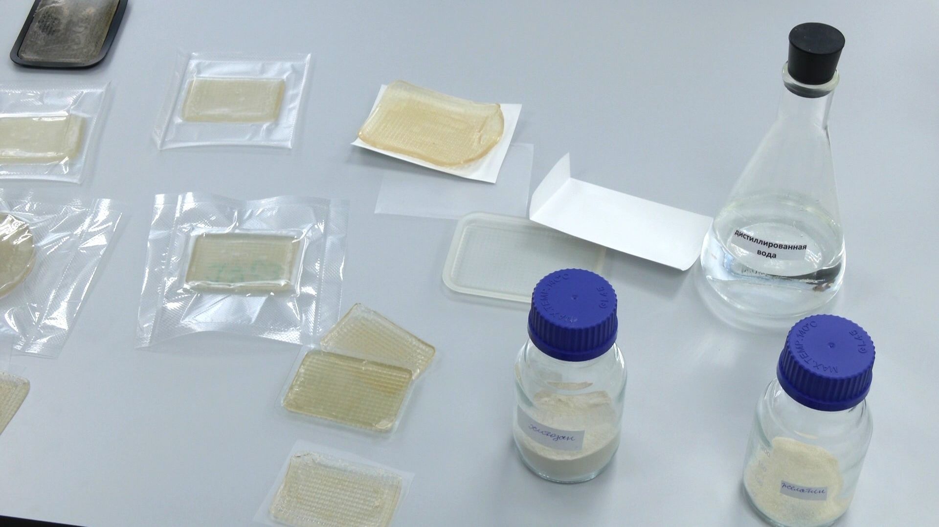 «Биокожа»: югорским врачам удалось сделать перевязки безболезненными