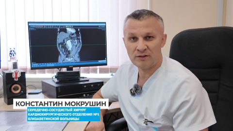 Разрыв аневризмы брюшного отдела аорты