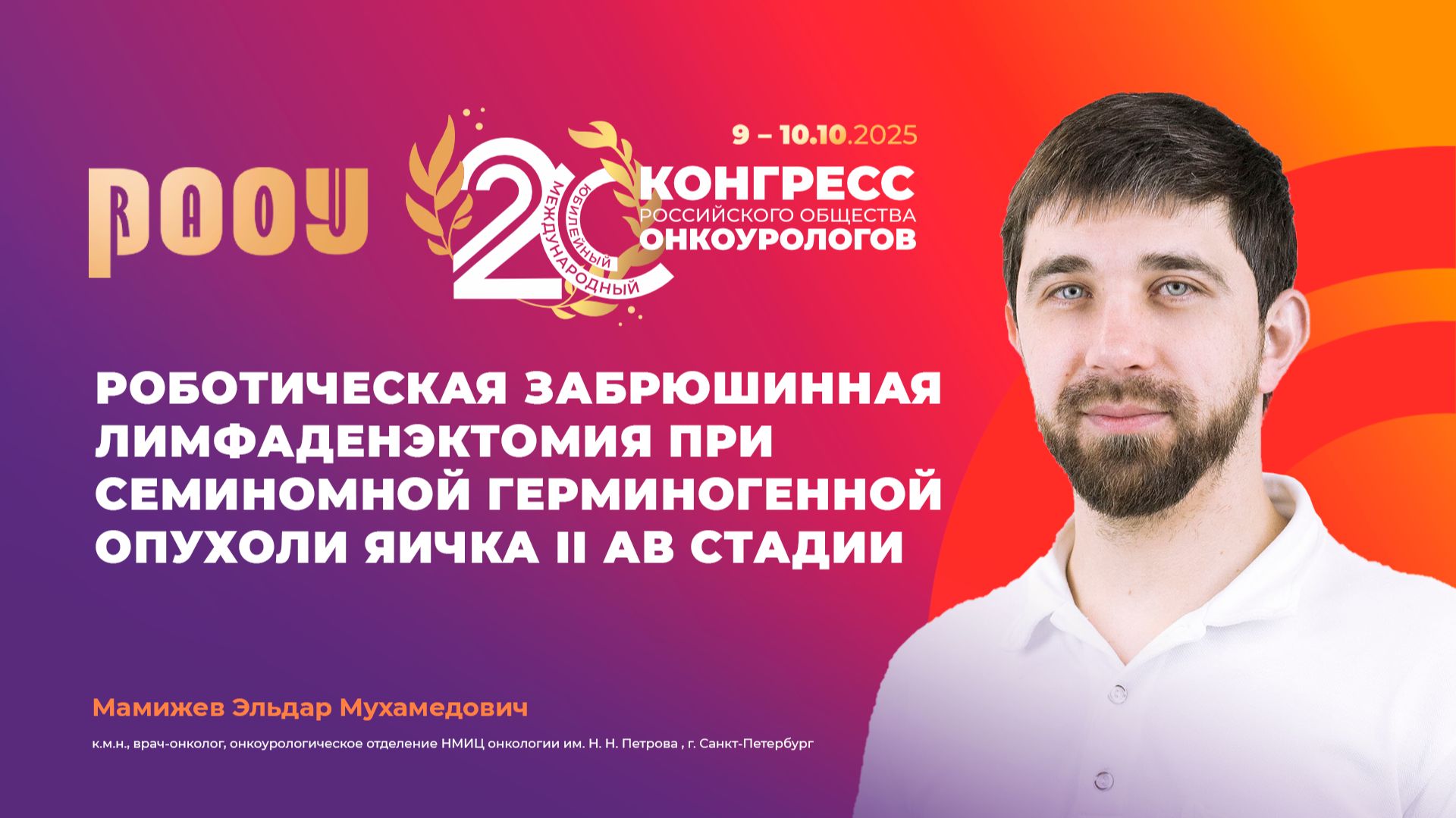 Роботическая забрюшинная лимфаденэктомия при семиномной герминогенной опухоли яичка II АВ стадии