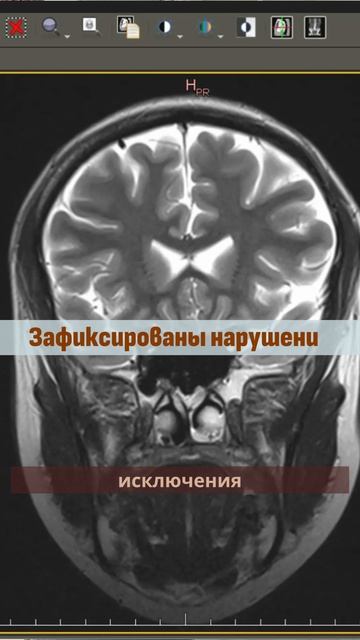 Рак желудка: экстренная операция и мнение немецкого онколога