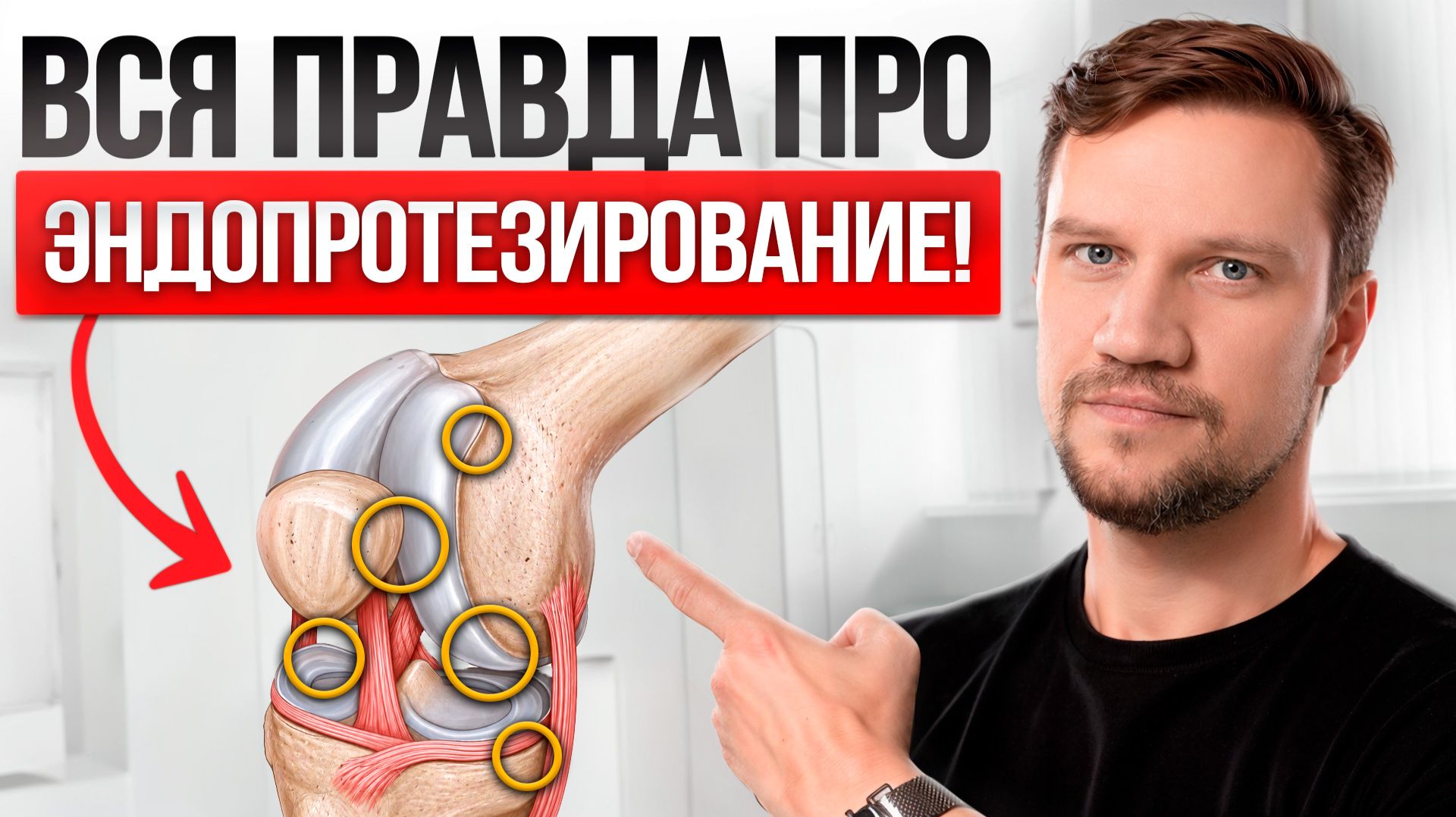 Что происходит со СВЯЗКАМИ во время ТОТАЛЬНОГО ЭНДОПРОТЕЗИРОВАНИЯ коленного СУСТАВА?