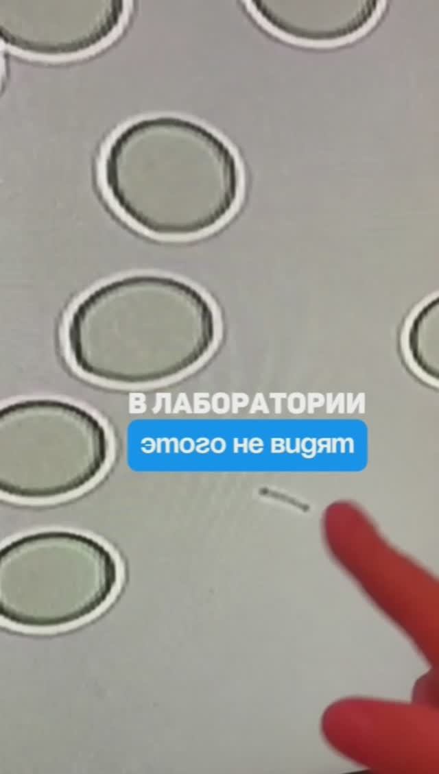 В лаборатории этого не видят. Семейный доктор Алена Братишко