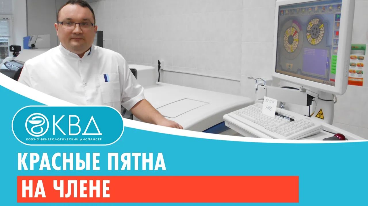 Красные пятна на члене. Клинический случай №58
