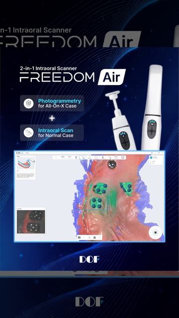 Сканирование All-On-X новым интраоральном сканером DOF FREEDOM Air