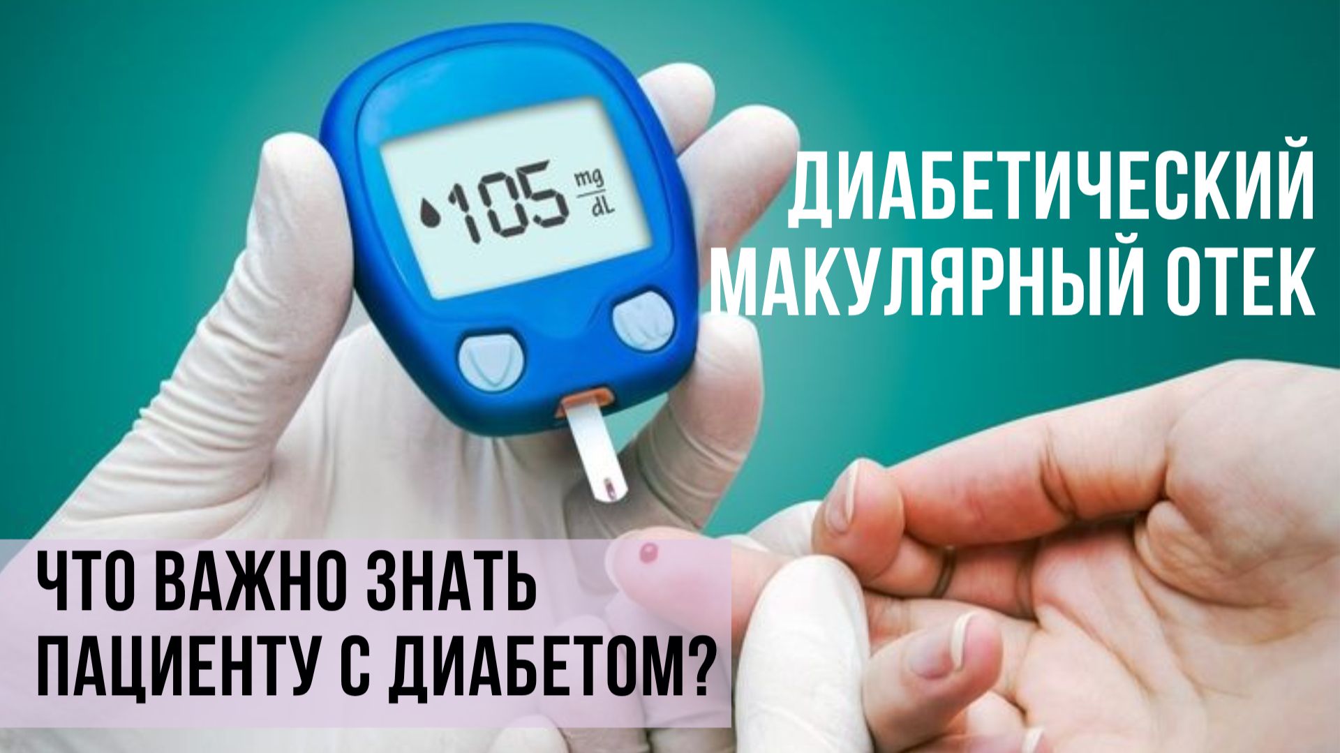 Диабетический макулярный отек: что важно знать пациенту с сахарным диабетом?