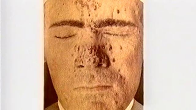 Современные методы диагностики и лечения болезней, передающихся половым путём