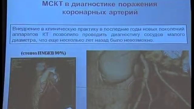 Современные подходы к диагностике и хирургическому лечению брахиоцефальных артерий у больных ИБС