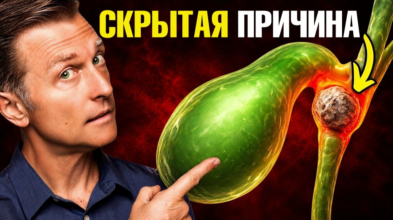 Настоящая причина камней в желчном пузыре: мифы и правда