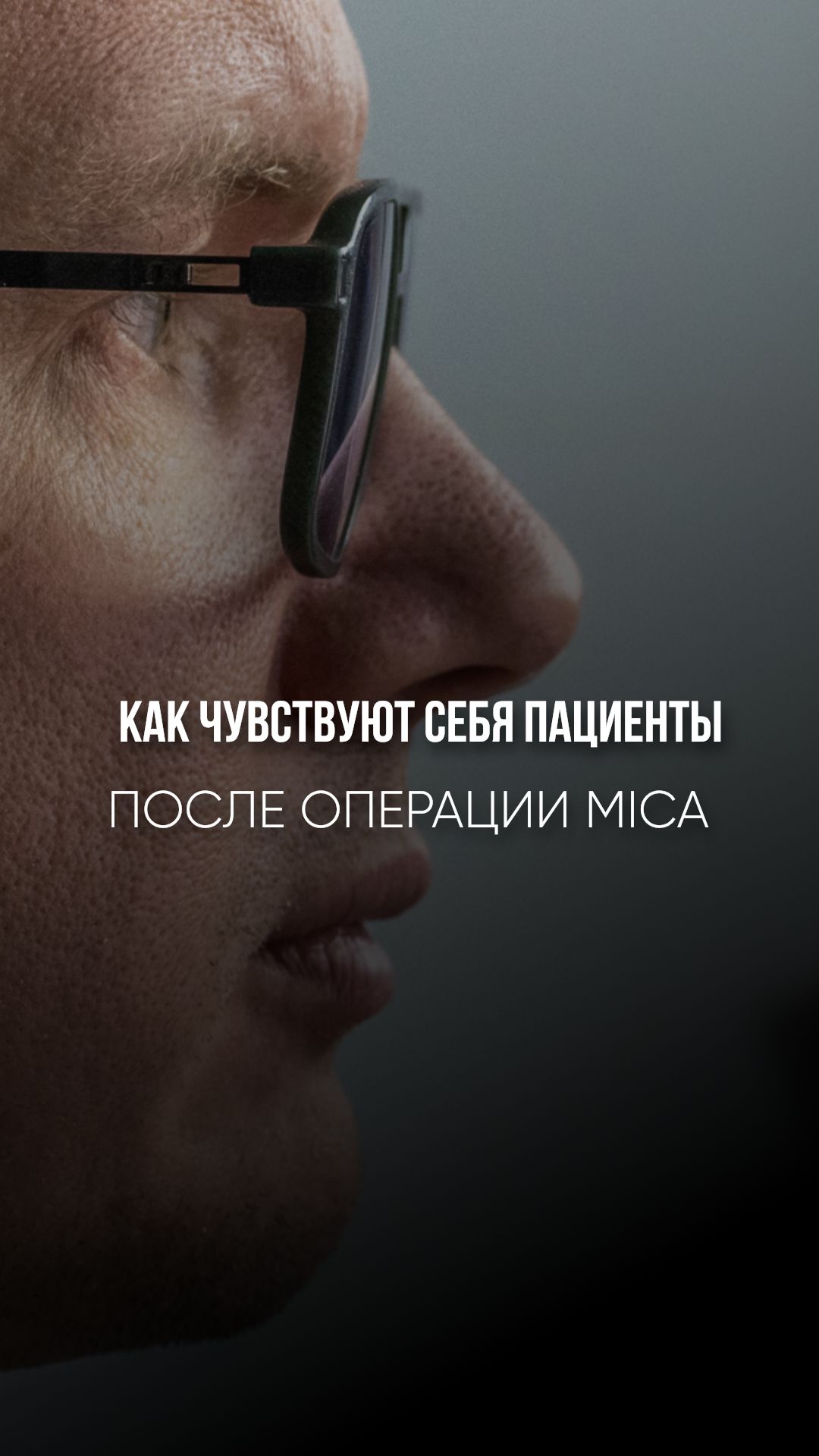 🤩Как чувствуют себя мои пациенты после коррекции Hallux valgus методом MICA