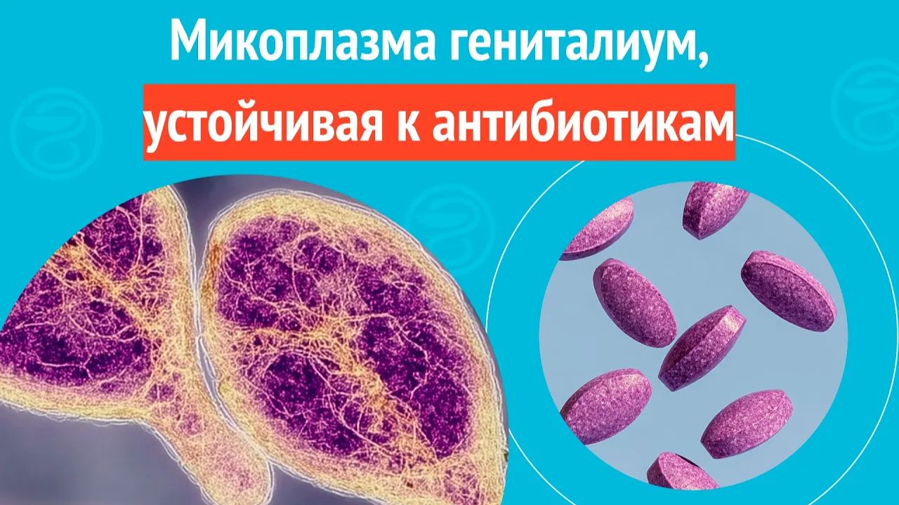 😠 Микоплазма гениталиум, устойчивая к антибиотикам. Клинический случай № 1782