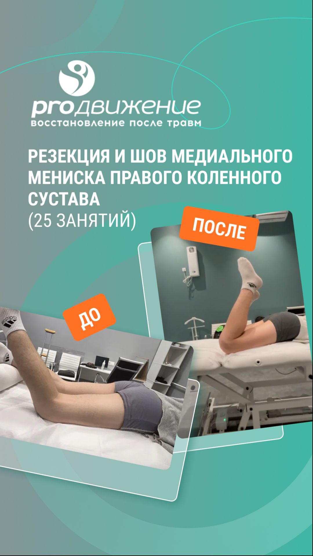 🦵 Восстановление после шва медиального мениска правого коленного сустава