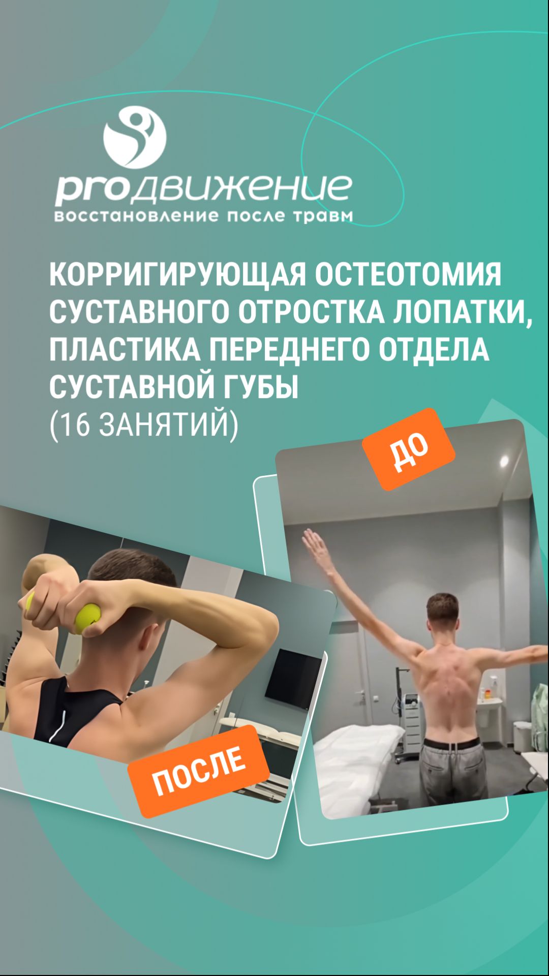 🩺 Реабилитация после корригирующей остеотомии
