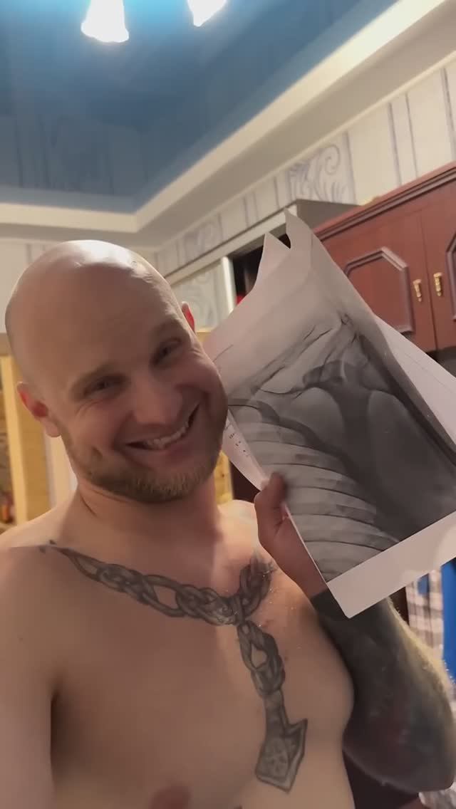 🔥😂 Я ПОЛУЧИЛ ТРАВМУ 🤣 (смешное видео, юмор, приколы, поржать, ржака, ржач, смешное 2026)