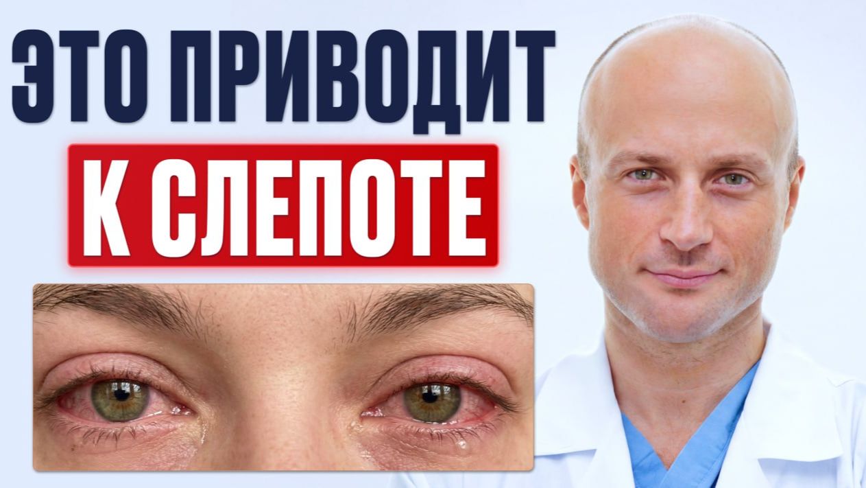 Эти 5 заболеваний ведут к СЛЕПОТЕ! Узнай, как сохранить ясное зрение до 100 лет. #здоровье