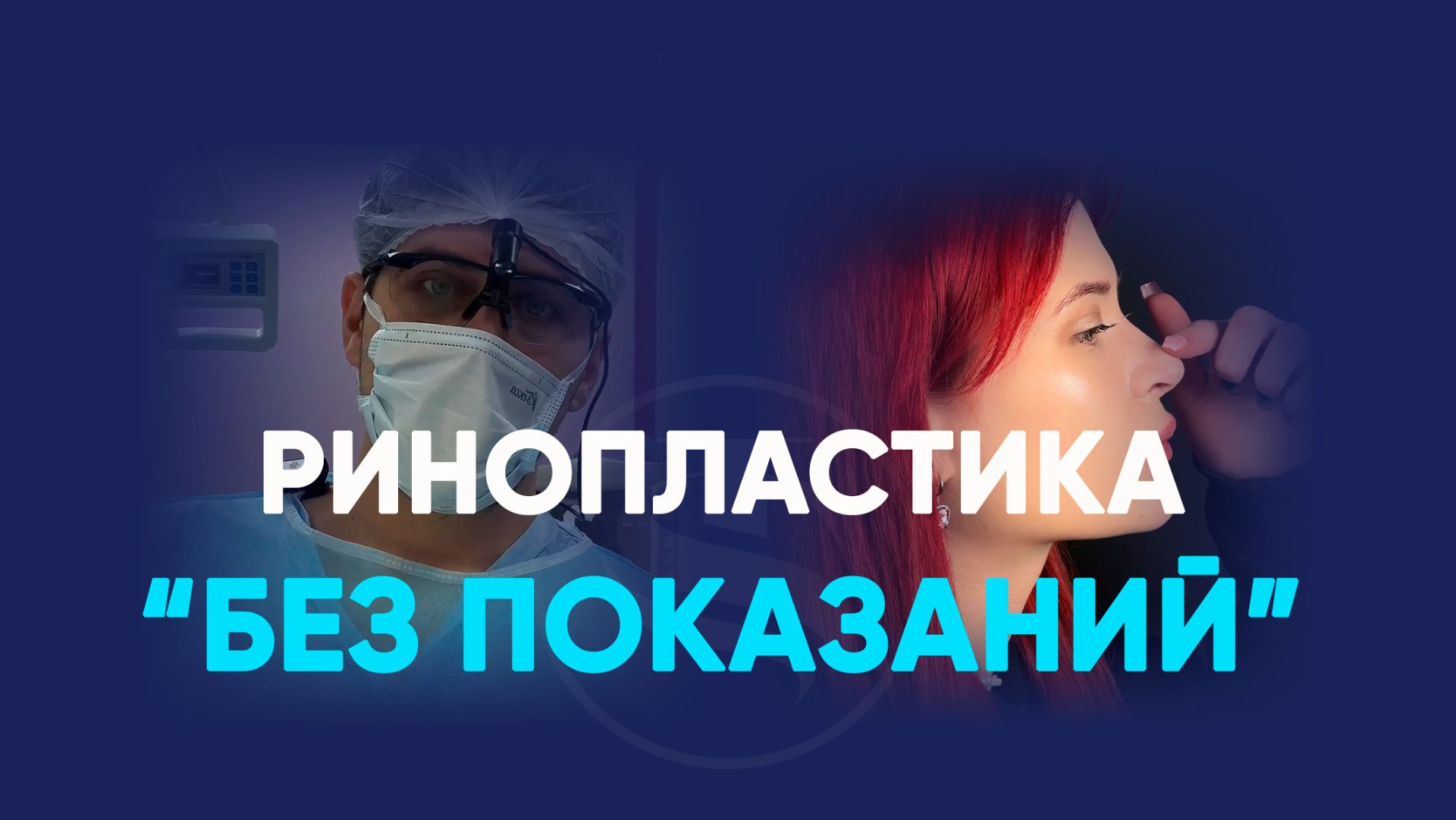 Открытая ринопластика: изменить кончик носа и сохранить индивидуальность