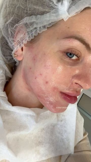 Аппарат для скульптурного массажа лица с RF лифтингом и EMS Biolift Neo m1501 Gezatone