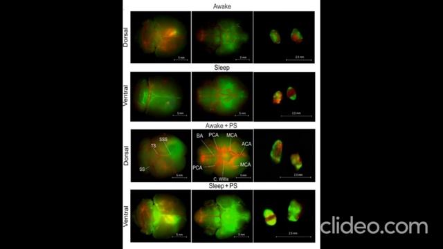 Technology of photobiomodulation of the mouse brain and its meninges during sleep