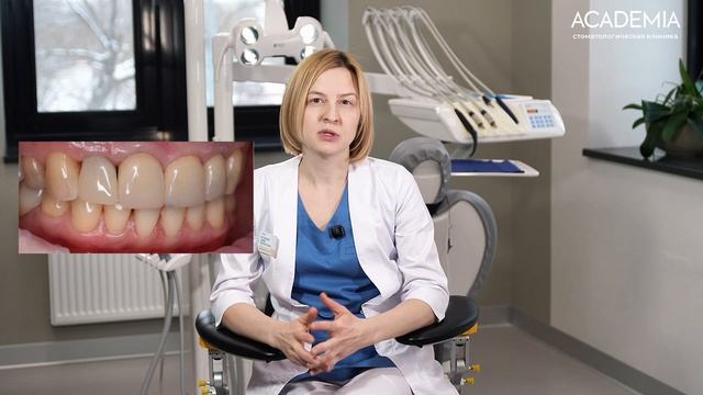 Имплантация переднего зуба: как заменить коронку и сохранить естественную улыбку