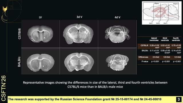 Differences in brain drainage and cognitive function between BALB/c and C57Bl/6 mice