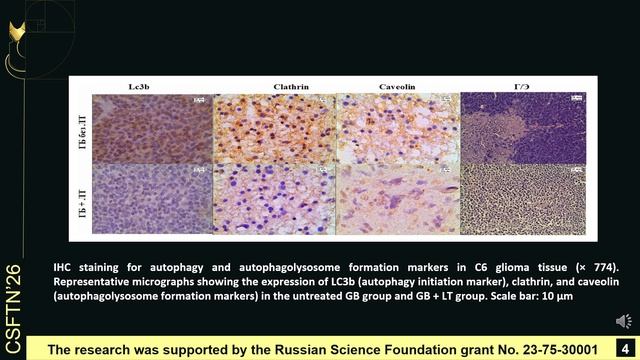 Non-invasive phototherapy of glioblastoma in rats