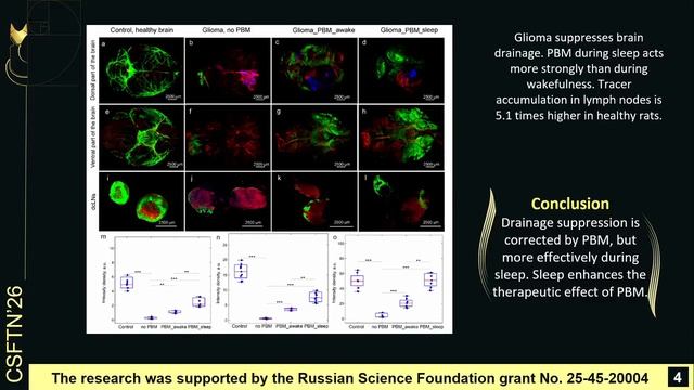 Effect of photobiomodulation during sleep and wakefulness on glioma growth and ...