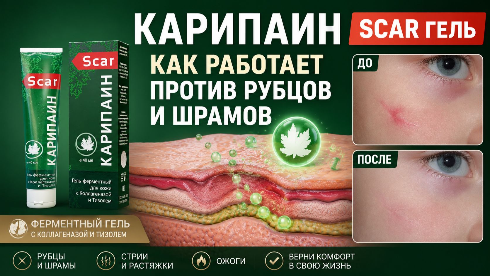 Карипаин Scar гель ферментный для кожи с Коллагеназой и Тизолем против рубцов, шрамов, стрии, ожогов