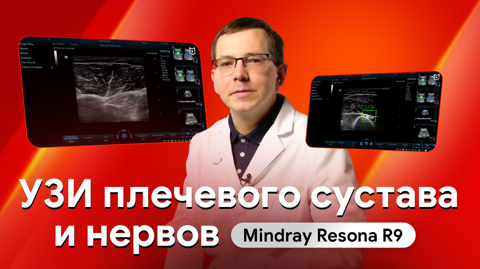Mindray Resona R9 на практике: УЗИ плечевого сустава и периферических нервов