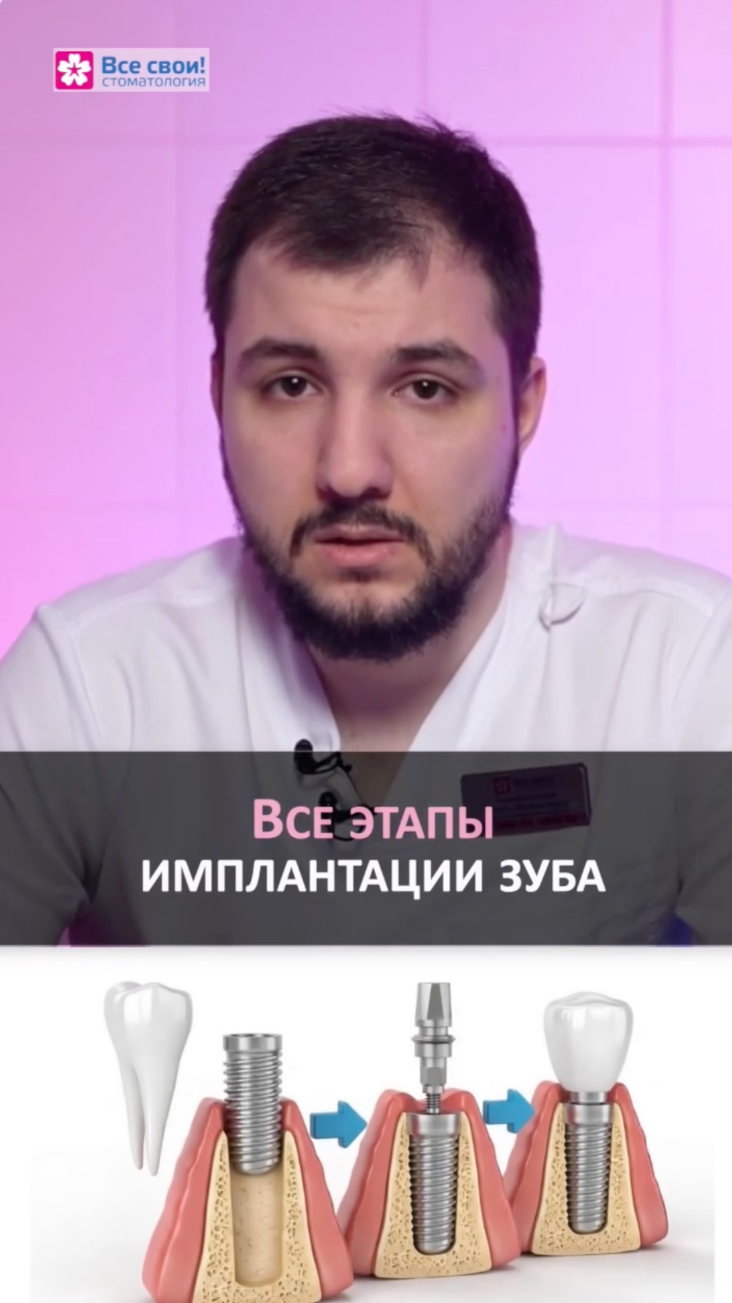 Одноэтапная имплантация и немедленная нагрузка: риски и показания