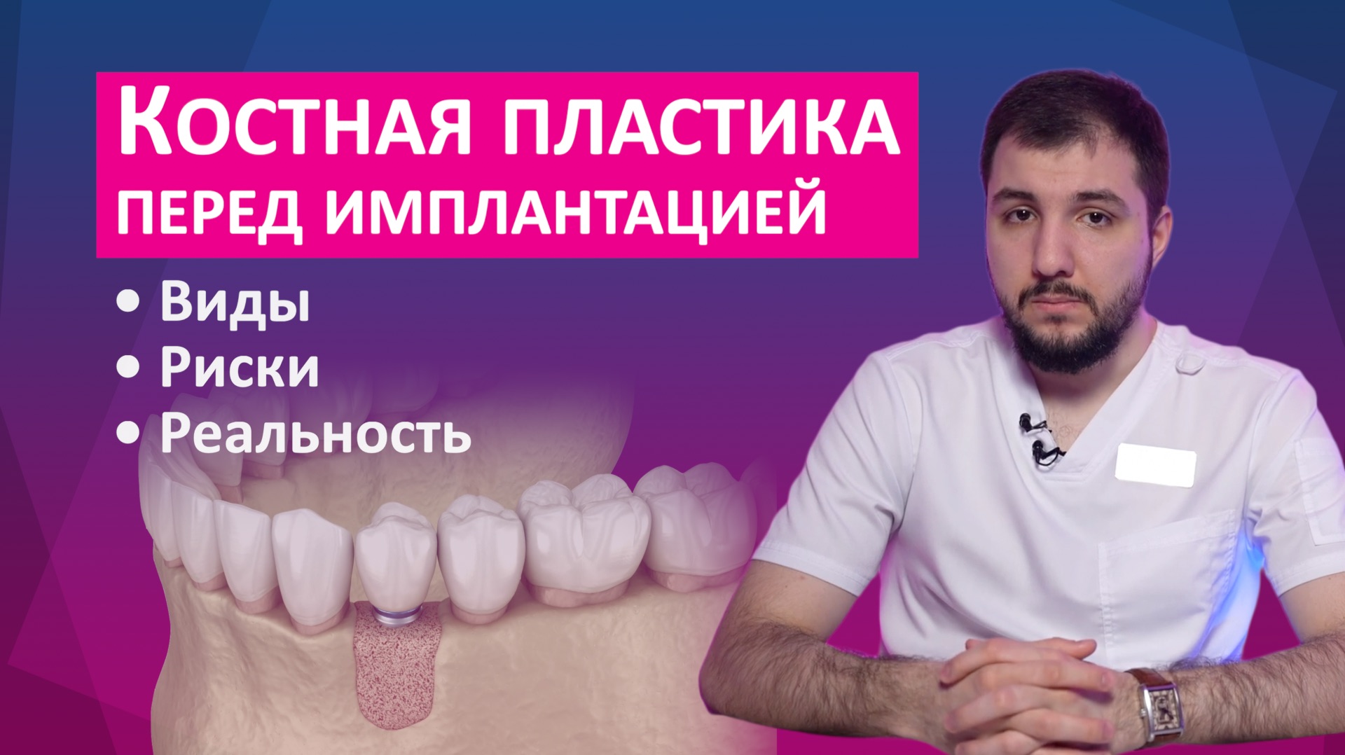 Все о костной пластике перед имплантацией зубов. Виды наращивания кости для импланта. Синус-лифтинг