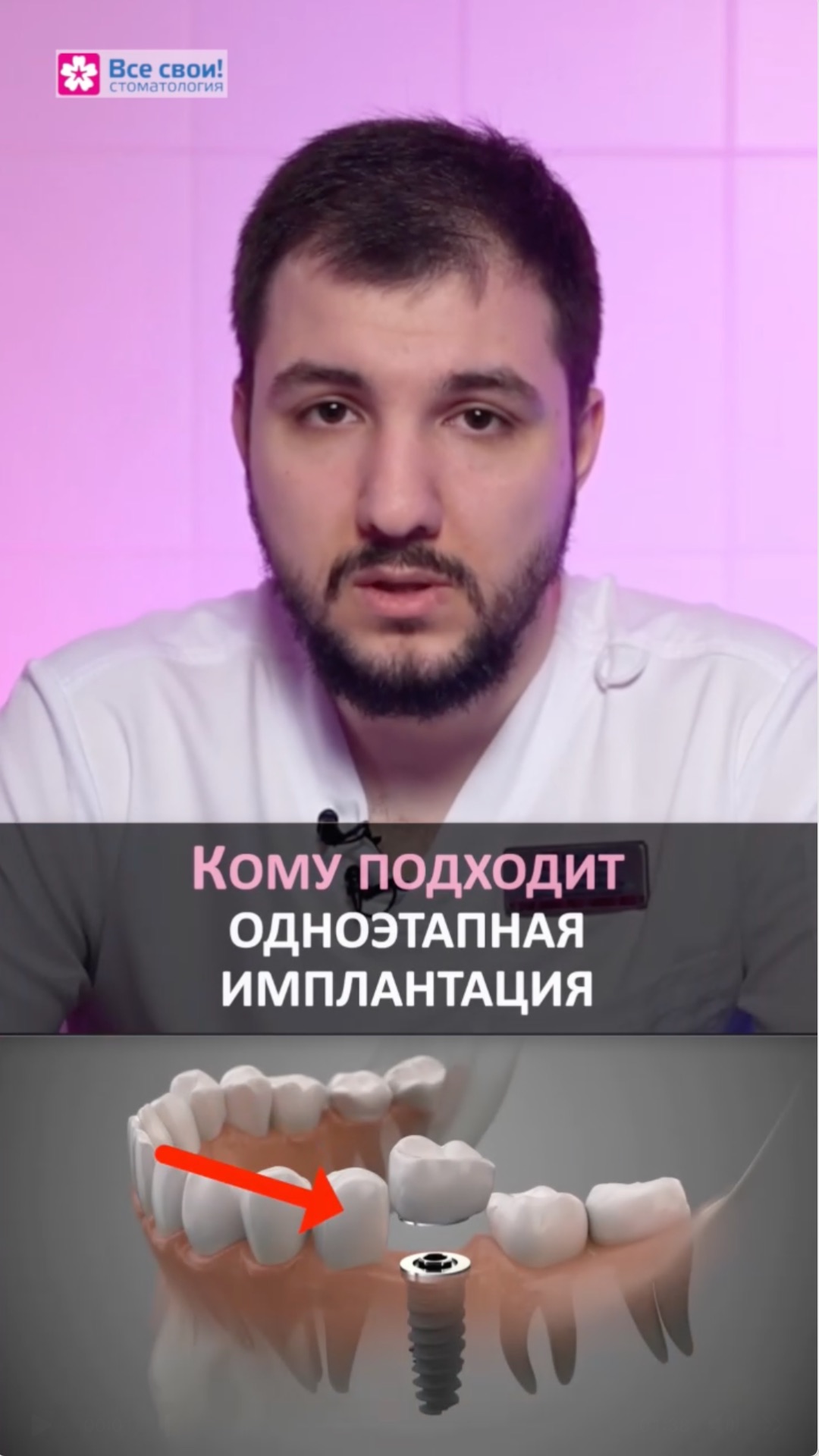 Одноэтапная имплантация: кому подходит и кому нет. Установка импланта сразу после удаления зуба