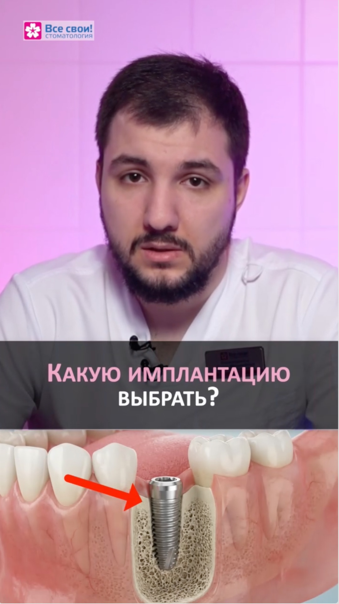 Одноэтапная имплантация и немедленная нагрузка: риски и показания