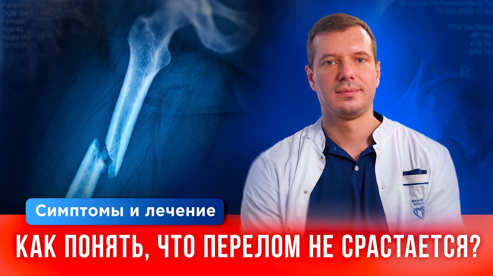 Несросшиеся переломы — что это и как их лечат?