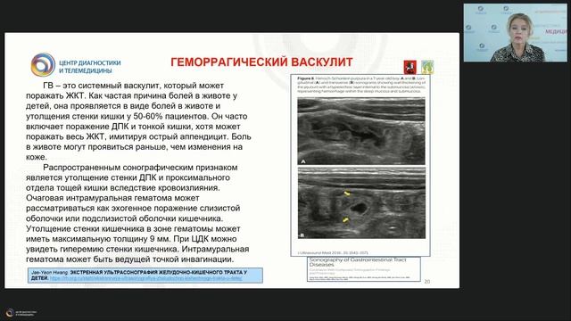 Особенности ультразвуковой диагностики заболеваний пищеварительного тракта