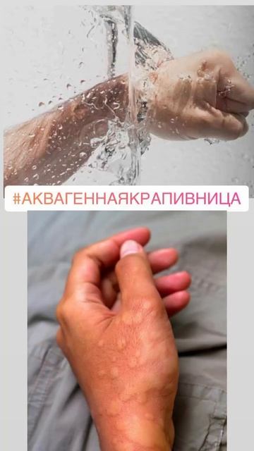 КРАПИВНИЦА