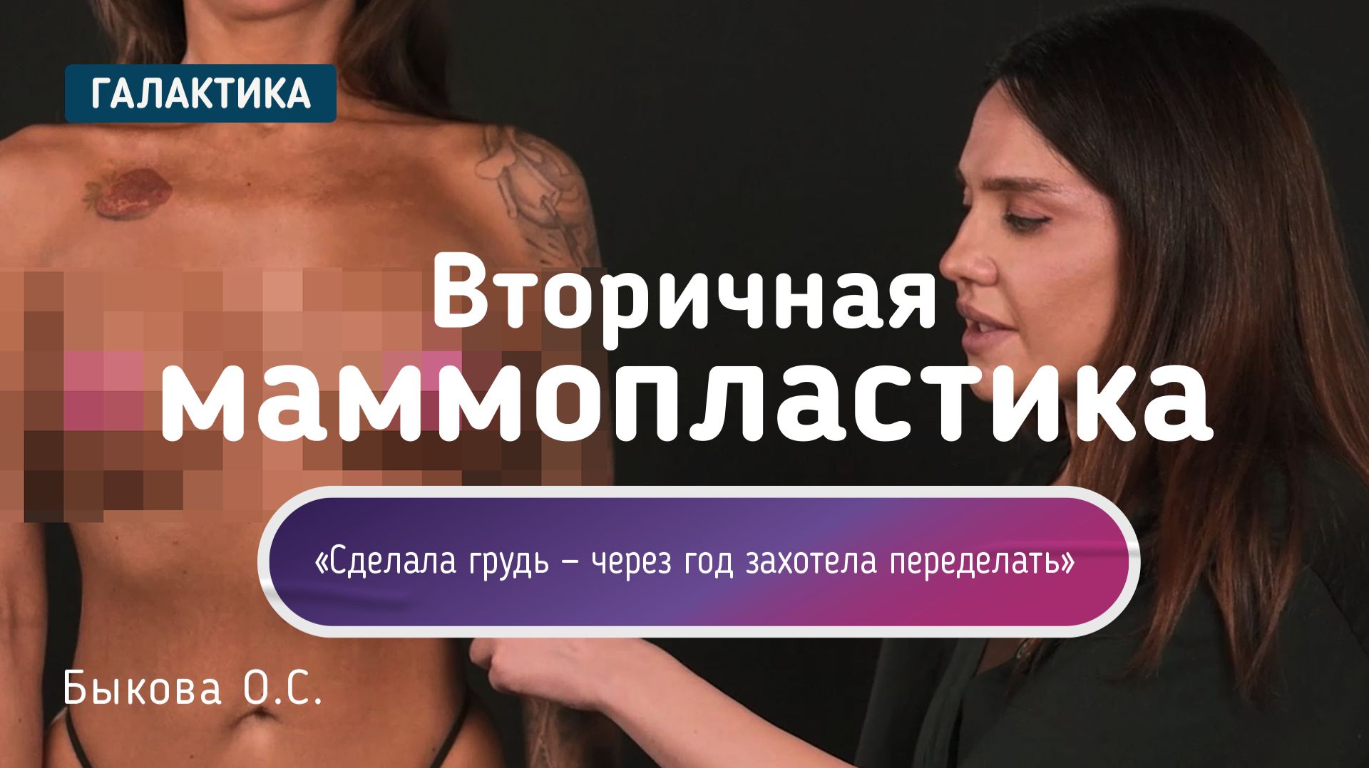 Замена имплантов спустя год | Почему переделываю маммопластику у Быковой Оксаны