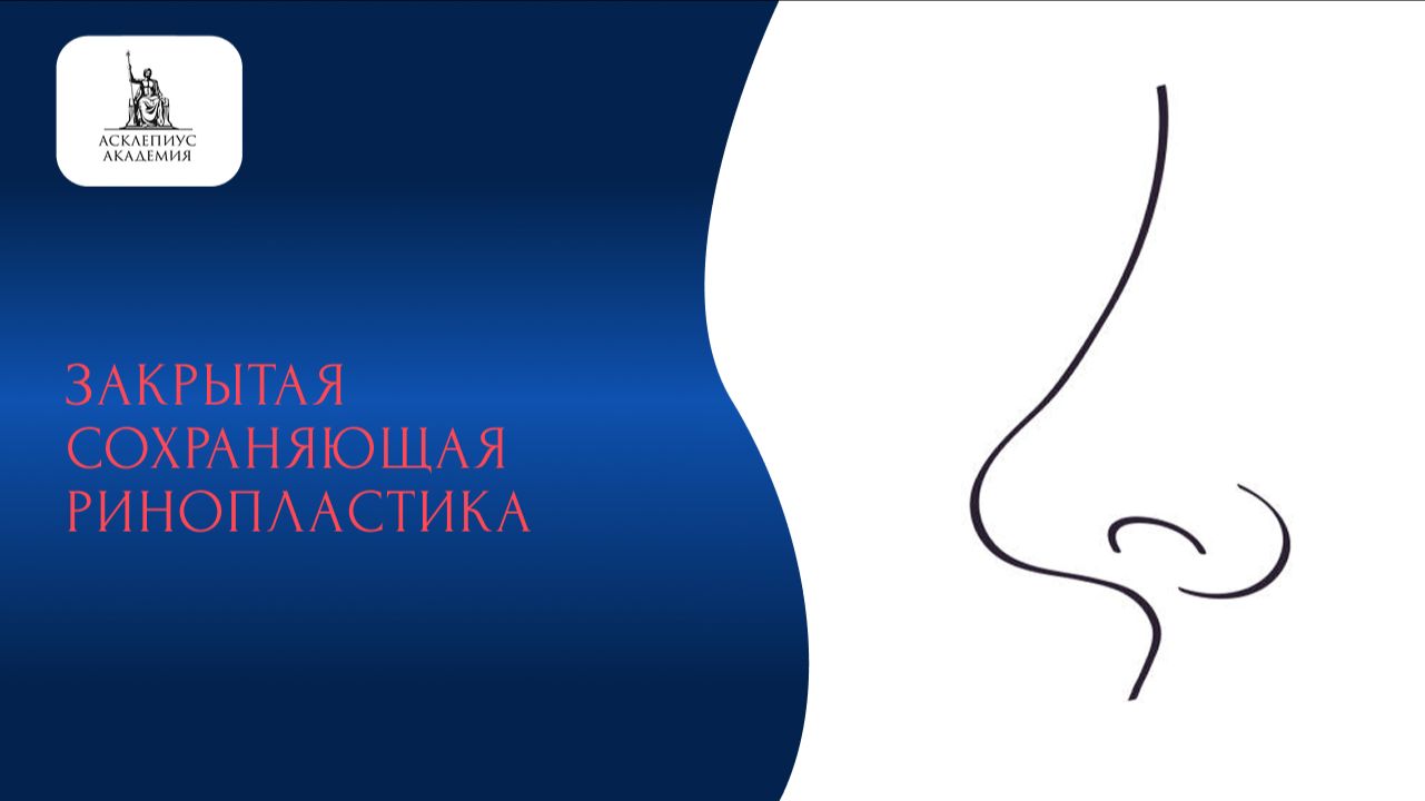 Закрытая сохраняющая ринопластика