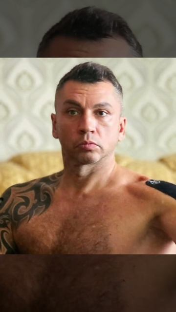 ☝ Мужское омоложение лица и шеи