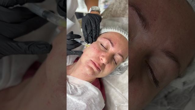 BLEMISH | ECTO-IN | VIT+AMINO Мастер-класс